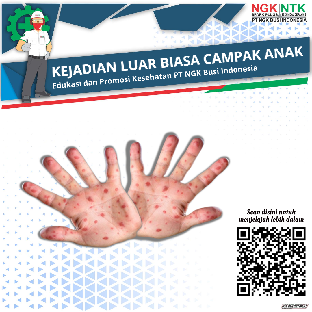 KEJADIAN LUAR BIASA CAMPAK ANAK